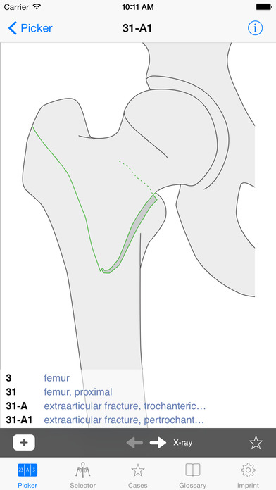 AO/OTA Fracture and Dislocation Classification on the App Store