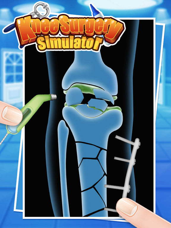 Knee Surgery Simulator - Surgeon Games Tips, Cheats, Vidoes and ...